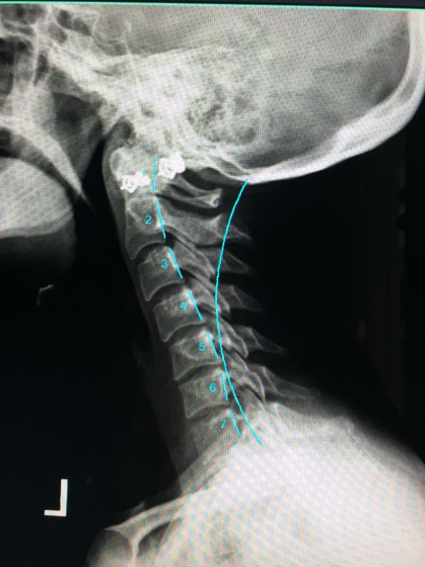 X-Rays in New Albany, MS | Medlin Chiropractic